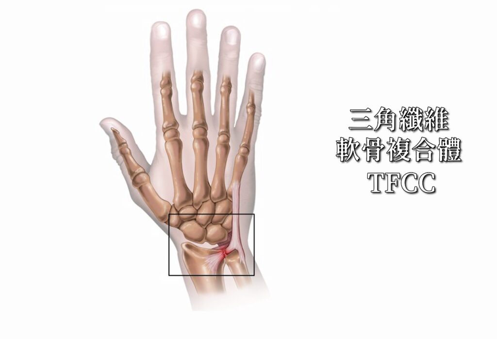 手腕一直痛嗎？來看一下TFCC的復健技巧吧！ - 啾c物理治療師